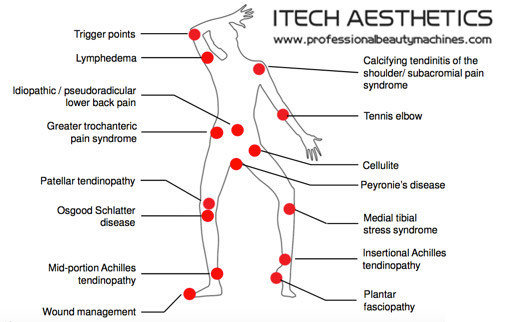 Non Invasive Shockwave Therapy Device For Heel Pain Plantar Fasciitis Treatment