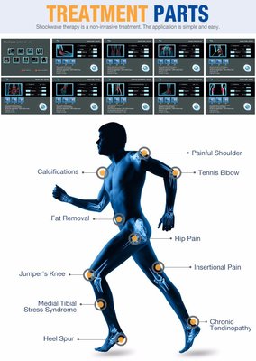 Eswt Shock Wave Professional Beauty Machines For Back Heel Knee Pain Relief
