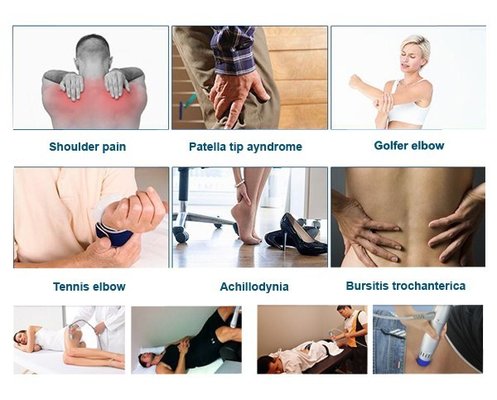 Eswt Shock Wave Professional Beauty Machines For Back Heel Knee Pain Relief