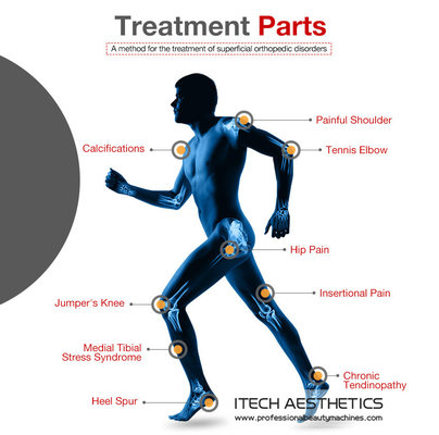 High Power Extracorporeal Radial Shock Wave Therapy Equipment For Plantar Fasciitis