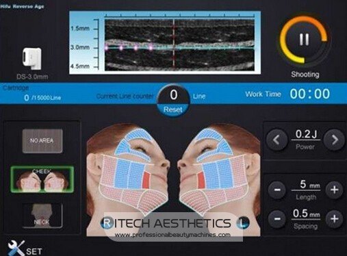 Safety SMART HIFU Device For Skin Tightening / Facial Massage / Anti Ageing
