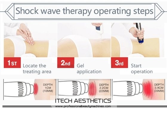 Extracorporeal Shockwave Therapy Medical Equipments For Knee Pain / Ed