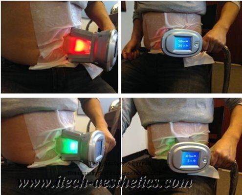 Cryolipolysis Body Slimming Machine Anti Freeze Membrane CE Listed