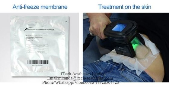 Cryolipolysis Body Slimming Machine Anti Freeze Membrane CE Listed