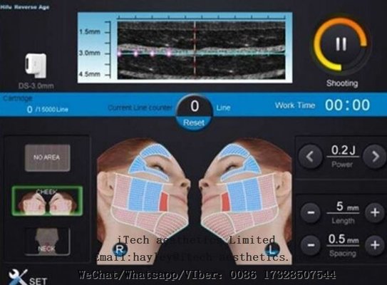 Wrinkle Removal Hifu Machines High Intensity Focused Ultrasound Machine Skin Tightening Hifu Face And Body