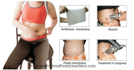 3 Sizes Cryo Antifreeze Membrane For Cryolipolysis Fat Loss Machines