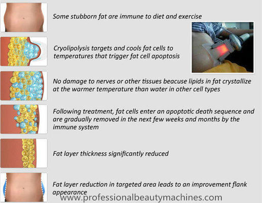 Dual Cryo Heads Cryolipolysis Slimming Machine , Fat Dissolving Machine 4 Handles