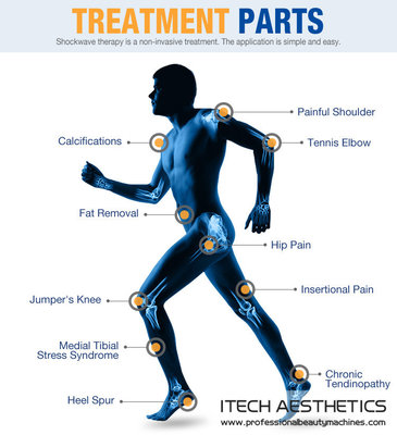 Beauty Clinic Use Eswt Shockwave Therapy Machine For Heel Pain / Plantar Fasciitis