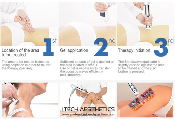 Eswt Shockwave Professional Beauty Machines For Musculoskeletal Disorders
