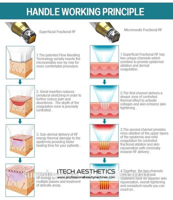 Cryo Electroporation / Fractional RF Microneedle Machine For Acne Scars Treatment