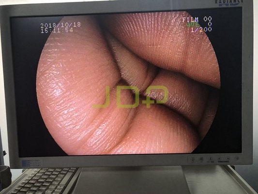 FUJINON ED-250XL8 Video Duodenoscope