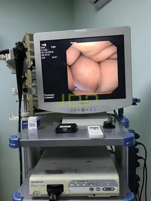 Olympus GIF-N180 Video Gastroscope