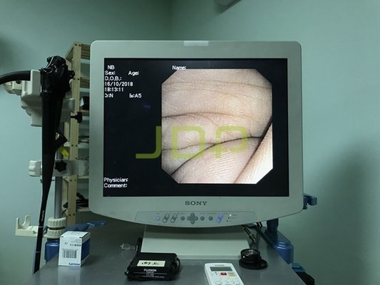 Olympus GIF-XP150N Video Gastroscope