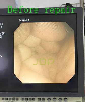 No angle and leakage of Olympus CF-240L Colonoscope for repair