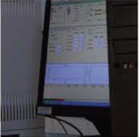 Gas Chromatography Mass Spectroscopy , single quadrupole mass spectrometry