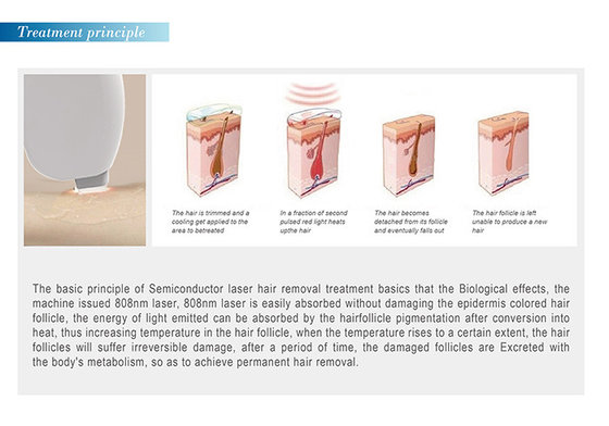 2015 High Power Men 808nm Diode Laser hair removing machine for permanent hair reduction