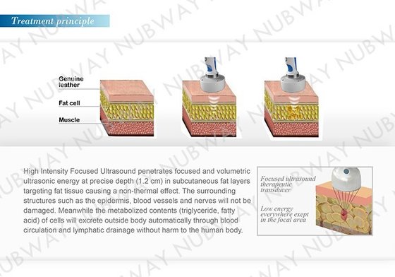 portable cavitation slimming machine hifushape fat loss hifu technology