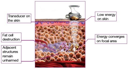hifushape slimming machine  Laser Lipoly slimming machine