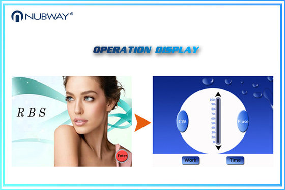 spider veins removal machine Derma Wand