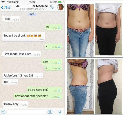 2016 newst!! -15oC 5 handles cryolipolysis fat reduction/ fat freezing slimming salon&clinic beauty machine with CE
