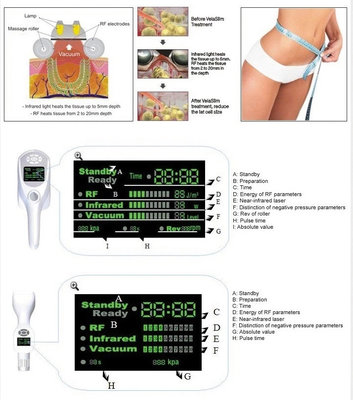 Cavitation RF Ultrasonic Slimming Machine Multi Functional Beauty Equipment
