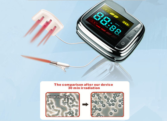 LLLT 650nm 18 Laser Therapy Watch / Semiconductor Laser Treatment Instrument