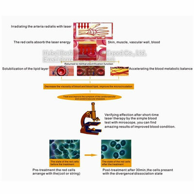 Wholesale New Age Products 18 LLLT Laser Blood Irradiation Device For Blood Sugar Blood pressure Diabetics Pain Relief