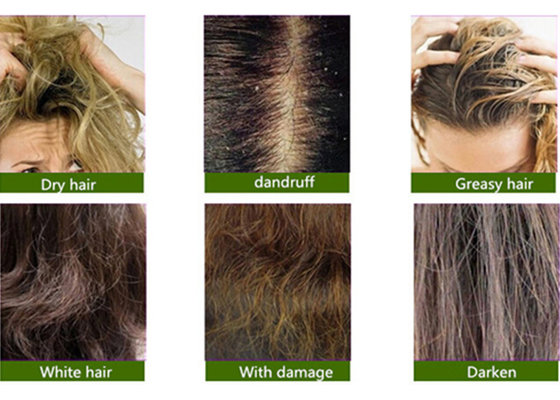 Electric Hair Growth Laser Comb Rebirth Hair Instrument For Hair Loss