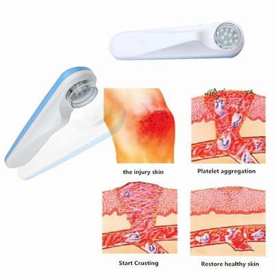 Physical Irradiation Laser Wound Healing Therapy For Pain Relief , Trauma , Injuries