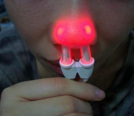 Laser radiation laser therapy intranasal light therapy devices for rhinitis