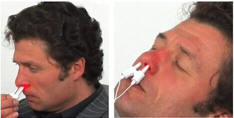 Blood pressure Laser radiation Nasal Laser Light Therapy