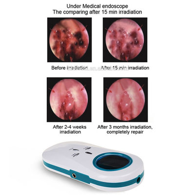 Healthcare Rhinitis Apparatus Treatment Diabetes Intranasal Light Therapy Devices