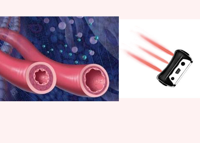 Semiconductor Laser Therapy Watch 12 Beams For Reducing Blood Pressure Blood Fat