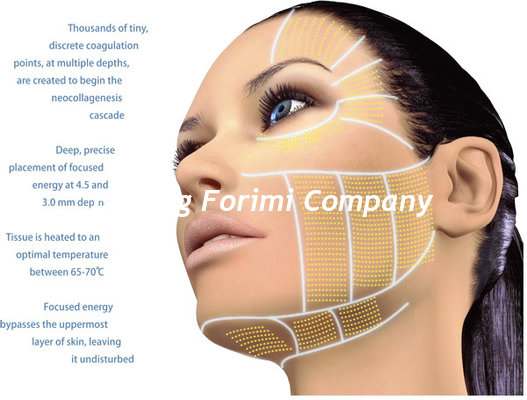 high frequency HIFU face firming HIFU-f  machine radio frequency devices for skin tightening