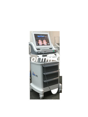 non invasive neck treatments machine HIFU-f  machine face firming treatment