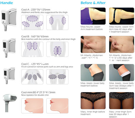 Forimi hot selling mulit-function -15 celsius 4 heads cryolipolysis slimming machine with CE approved