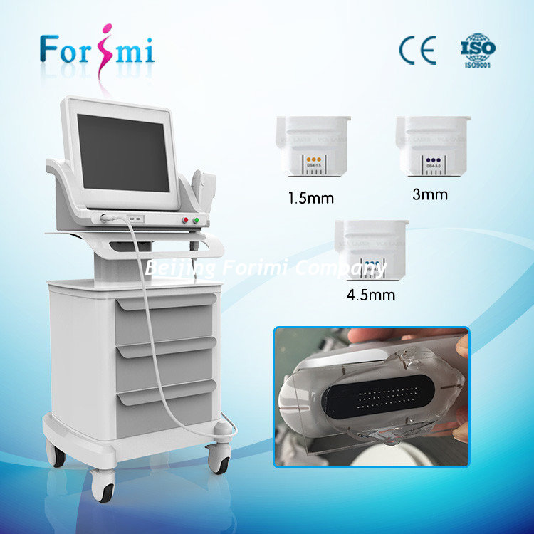 small device rf face non surgical lift face machine hifu frequency HIFU face firming ultrasound HIFU