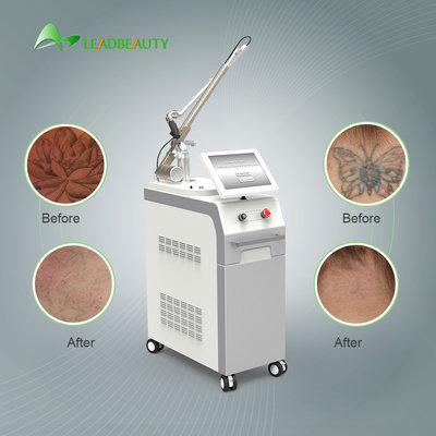 1064 / 532nm q switch Nd Yag laser tatoo removal machine with Korea imported light guide arm for salon clinic use