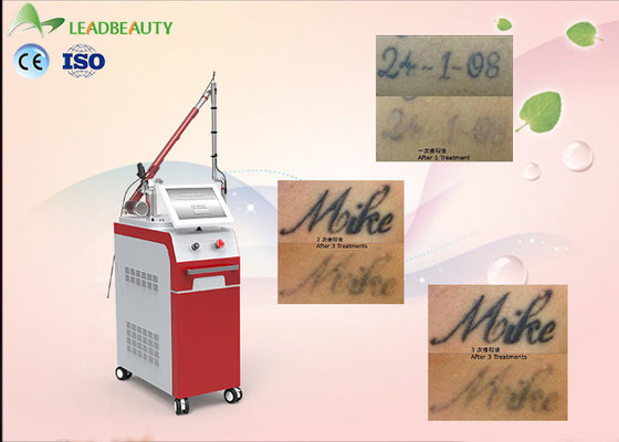 Korea imported 1064 / 532nm Q Switched Nd Yag Laser /Tattoo Removal Machine /Laser Tattoo Removal Skin Care Picosure mac