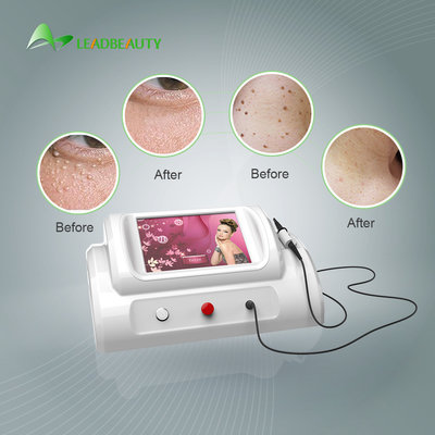 30Mhz high frequency Spider Vein removal price / using for vascular removal with 8.4 inch screen /150W skin tag removal