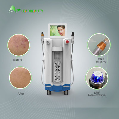CE Certification Professional Fractional Rf 80W 0-3Nn Adjustable Mole Skin Tag Removerrf radio frequency skin tightening