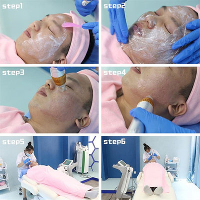 Fractional Radiofrequency Micro Needling Machine For Skin Rejuvenation 25/49/81 Pins 5MHZ