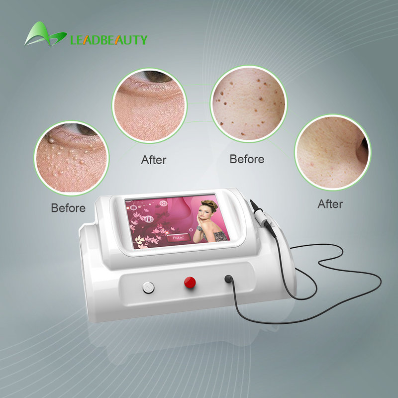 30Mhz high frequency Spider Vein removal price / using for vascular removal with 8.4 inch screen /150W skin tag removal