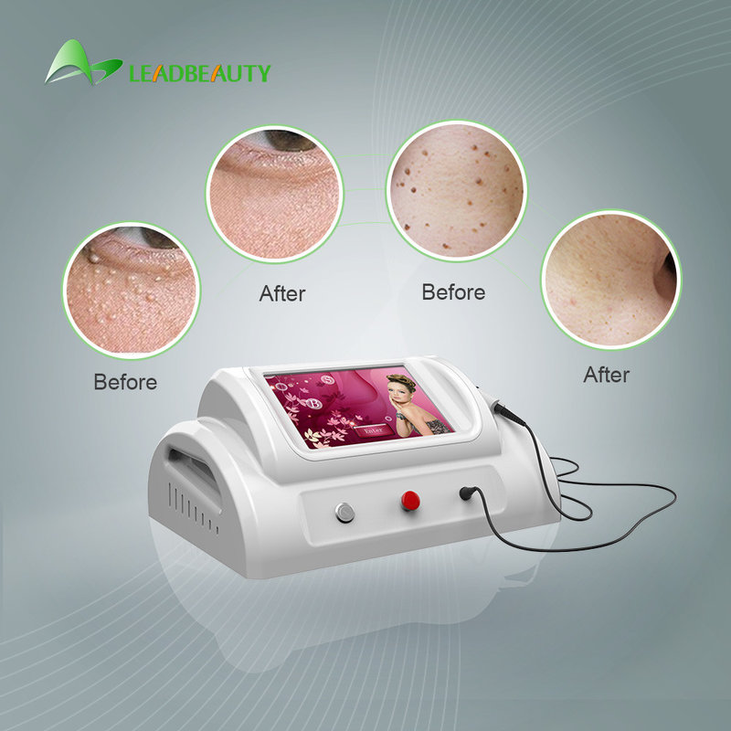 30Mhz high frequency Spider Vein removal price / using for vascular removal with 8.4 inch screen /150W skin tag removal