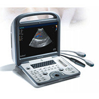 China Portable Color Doppler Ultrasound supplier