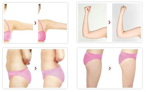 Body Lipo Laser Slimming Machine