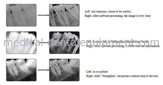 CMOS Digital Dental X - Ray Sensor Black With Large Active Area