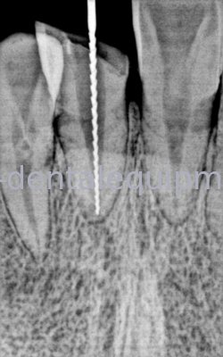 CMOS Digital Dental X - Ray Sensor Black With Large Active Area