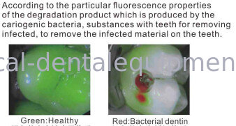 C - Hunter Dental Apex Locator For Tooth Detection With LED Light