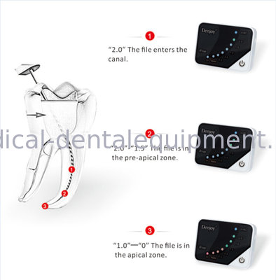 Mini Dental Apex Locator High Accurate For Endodontic Treatment
